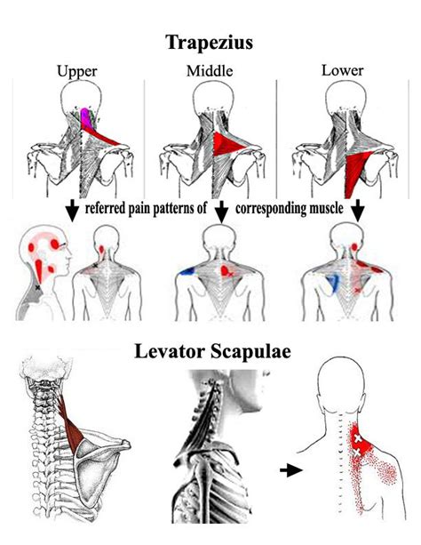 109 Best Images About Triggerpoints On Pinterest Knee Pain Massage And Muscle