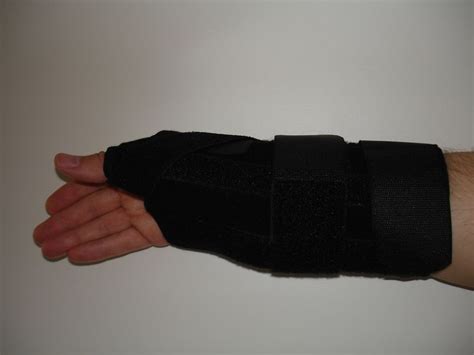Cock Up Wrist Splint WikiSM Sports Medicine Wiki