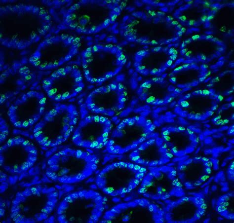 Ire1 Alpha Antibody Pa5 20189