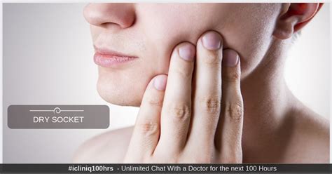 What Is A Dry Socket Causes Risk Factors Treatments