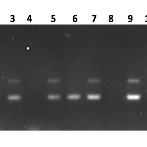 Multiplex Pcr Consist Of Il 10 Rs1800896 Primer G Vs Primer A Genotype Download Scientific