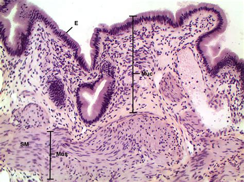Normal Gallbladder Histology My Xxx Hot Girl