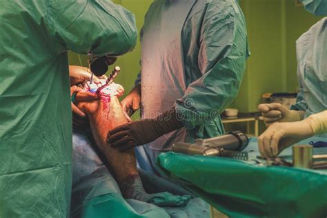 Chirurgie am Operationssaal Stockfoto Bild von ausrüstung