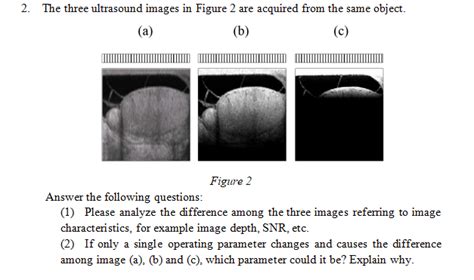 Solved 2 The Three Ultrasound Images In Figure 2 Are Chegg