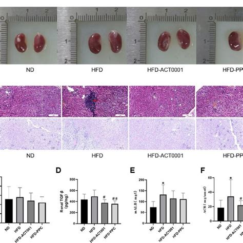 Act001 Alleviates Renal Lipid Accumulation In Hyperlipidemic Mice A