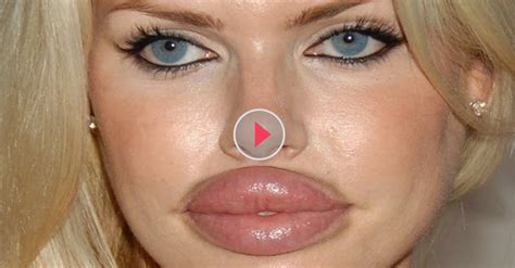 Worst Plastic Surgeries Ever This Is So Unbelievable Viralmisery