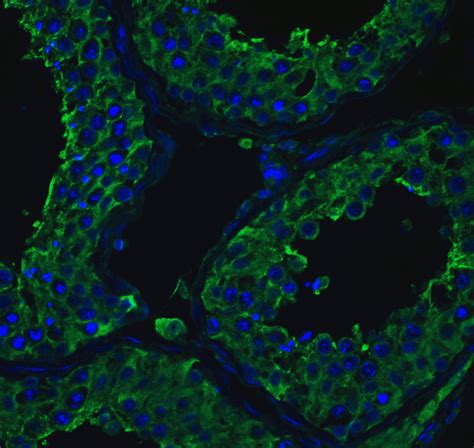 Ace2 Antibody Cat No 3217 Prosci
