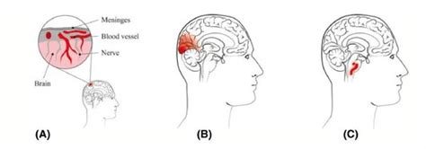 Apakah Kegunaan Norepinephrine Tartrate Pengetahuan