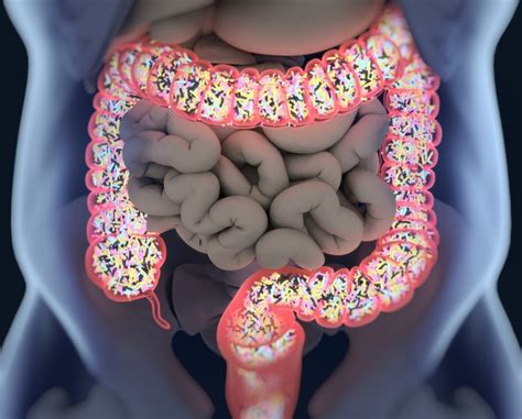 Diverticulite O Que é Causas Sintomas E Tratamentos Dicas De Saúde