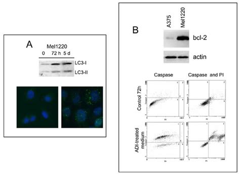 A Autophagy As Detected By Increased Lc3 Ii By Western Blot And
