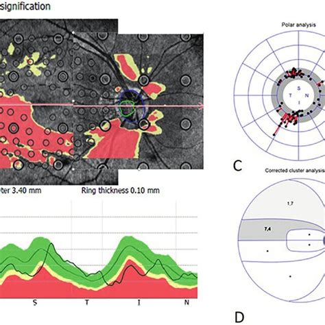 Spatial Correspondence Of Structural Functional Indicators A Download Scientific Diagram