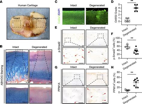 JCI Insight Protein Phosphatase PPM A Inhibition Attenuates Osteoarthritis Via Regulating TGF