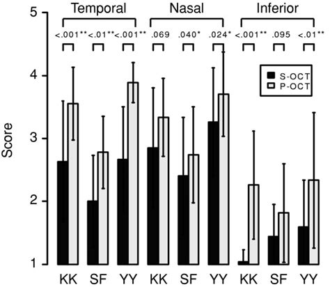 Visibility Of Trabecular Meshwork By Standard And Polarization Sensitive Optical Coherence