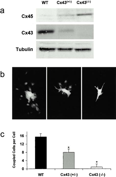 cx expression and cell coupling in calvaria osteoblasts derived from