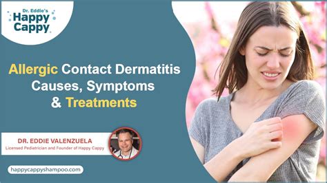 Allergic Contact Dermatitis Your Guide To Healthy Skin Dr Eddie