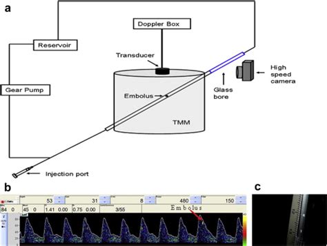 A A Schematic Of The Flow Phantom Used For The In Vitro Experiment Download Scientific