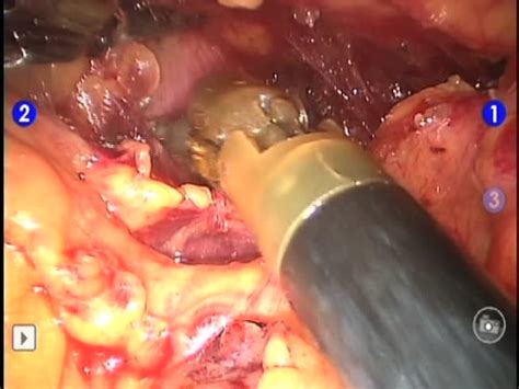 Clinical Robotic Surgery Association