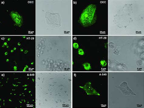 Confocal Fluorescence Microscopy Images Showing The Bronchoscopic