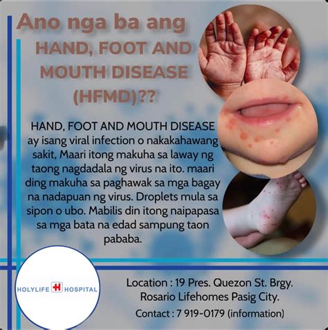 Ano Nga Ba Ang Hand Foot And Mouth Holylife Hospital