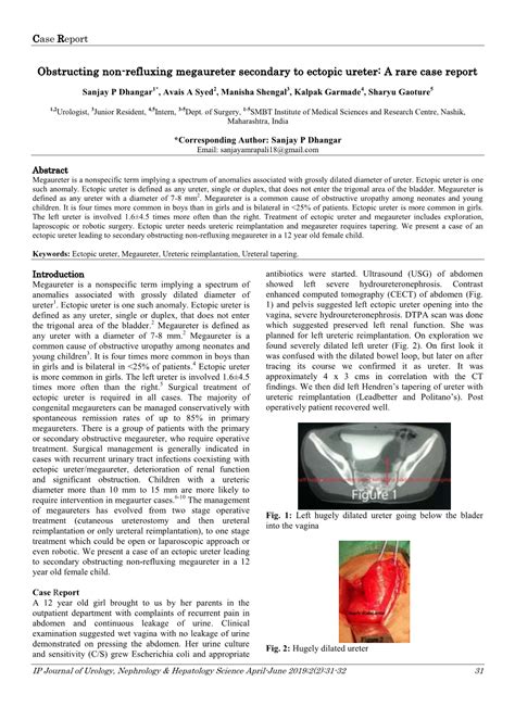 Obstructing Non Refluxing Megaureter Secondary To Ectopic Ureter A