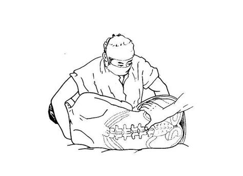 腰椎穿刺图片 腰椎图片 腰椎术图片 第8页 大山谷图库