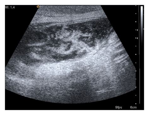 Abdominal Wall Transabdominal Ultrasonography In Longitudinal Plane Download Scientific Diagram