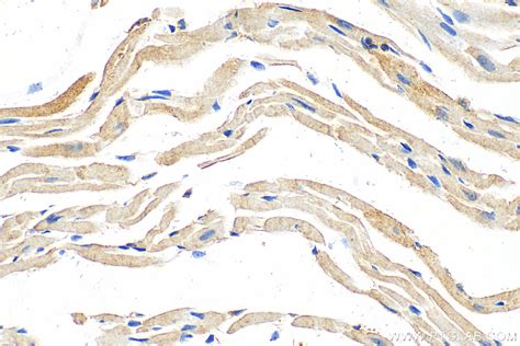 Mchr1 Antibody 11656 2 Ap Proteintech