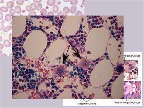 Platelet Disorders Pptx