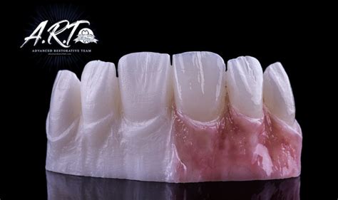 Jack Marrano Case 1 Miyo World