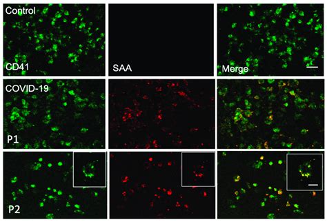 Saa Partially Colocalizes With Cd41 Immunofluorescence Was Performed Download Scientific