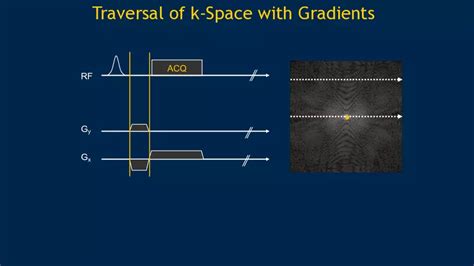 Mri Physics Frequency And Phase Encoding Edubirdie