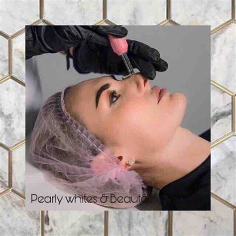 Pdo Threads Lifting Sutures Artofit