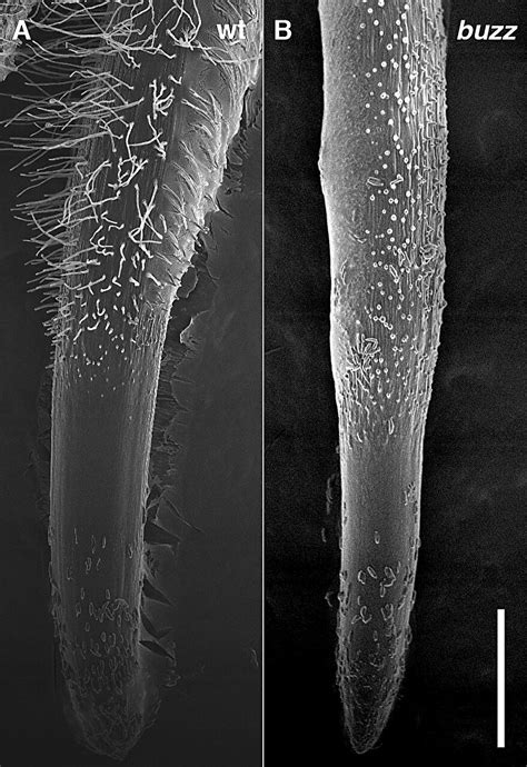 Root Hairs Microscope What Does Hair From The Root Look Like Under The