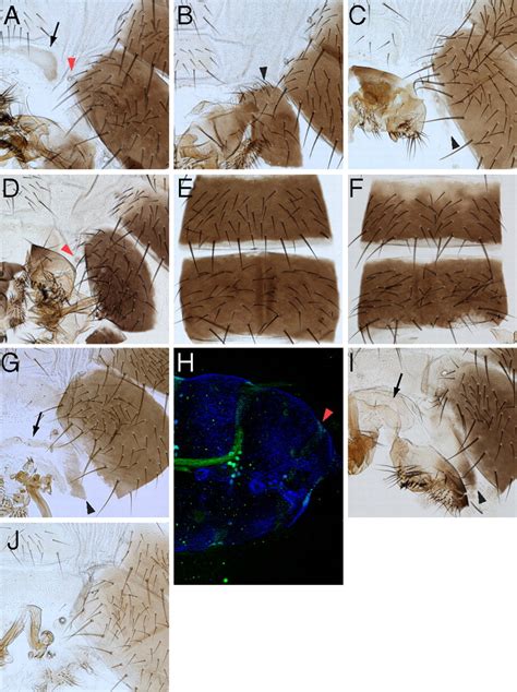 Sexually Dimorphic Regulation Of The Wingless Morphogen Controls Sex
