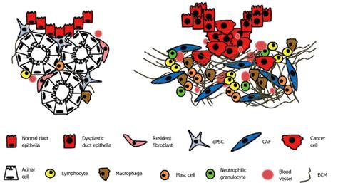 Desmoplastic Reaction In Pancreatic Ductal Adenocarcinoma The Normal