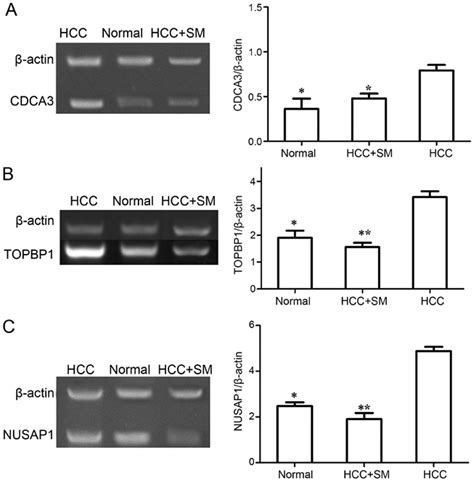 The Expression Of A Cdca3 B Topbp1 And C Nusap1 In Normal Liver