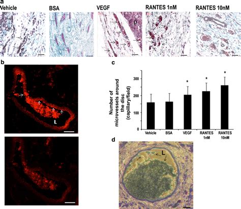 Figure 1 From Rantes Ccl 5 Induced Pro Angiogenic Effects Depend On