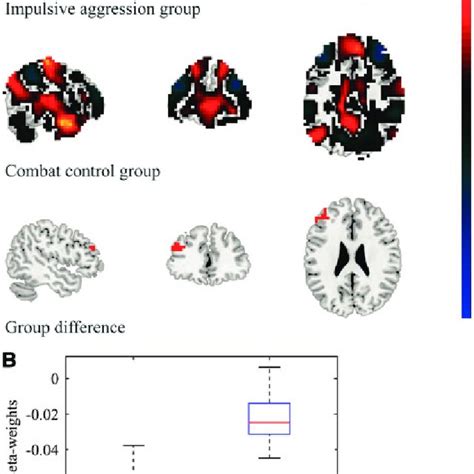 Reduced Negative Functional Connectivity Between The Right Bla And Left