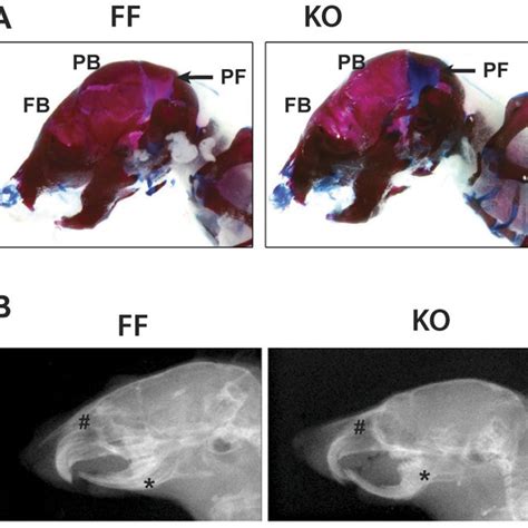 Mct Evidences Osteopenic Bones In P38a Deficient Bones Of 12 Week Old