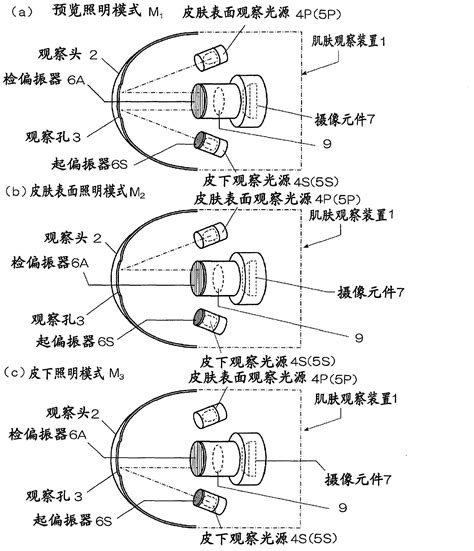 Skin Observation Device Eureka Patsnap