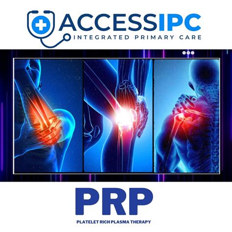 Unlocking The Healing Power Of Platelet Rich Plasma Prp