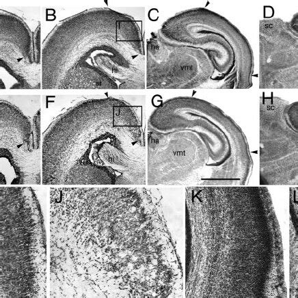 Cytoarchitecture And Cellular Phenotypes Of The Temporal Cortex At Download Scientific Diagram