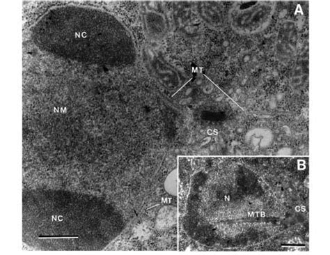 Electron Micrographs Of Sections Through The Boundary Between
