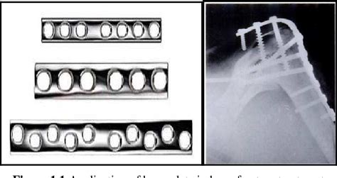Figure From Investigation Of The Microscopic Deformation Behavior And Surface Quality Of