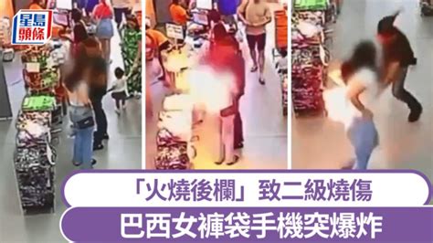 巴西女逛超市手機突爆炸 牛仔褲冒火球致二級燒傷有片 星島日報