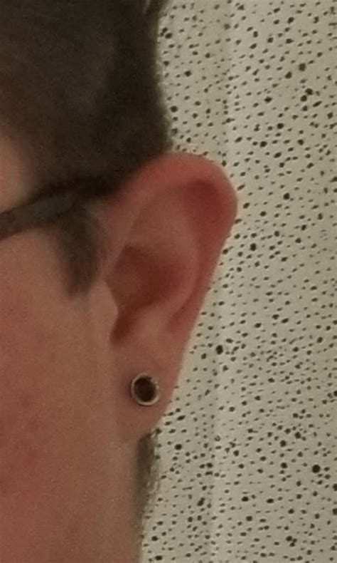 Didnt Realize How Small My Lobes Used To Be Thanks To The Other User