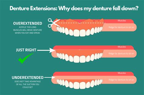 Common Denture Problems Solutions And Tips For A Comfortable Fit