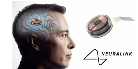 Transformative Breakthrough Neuralink Celebrates 100 Days Of Empowering Neurological Independence