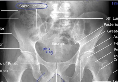 Lab Norm Variance Lower Extrem Flashcards Quizlet