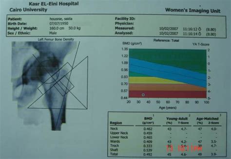 DEXA Lumbar Spine With T Score 4 5 Download Scientific Diagram